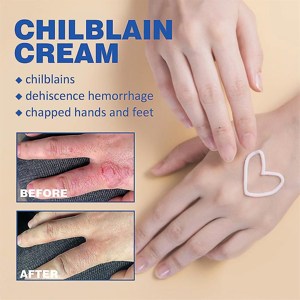 1/2/3Pcs 30g Chilblain Cream Anti-cracking Frostbite Moisturiser Deep ...