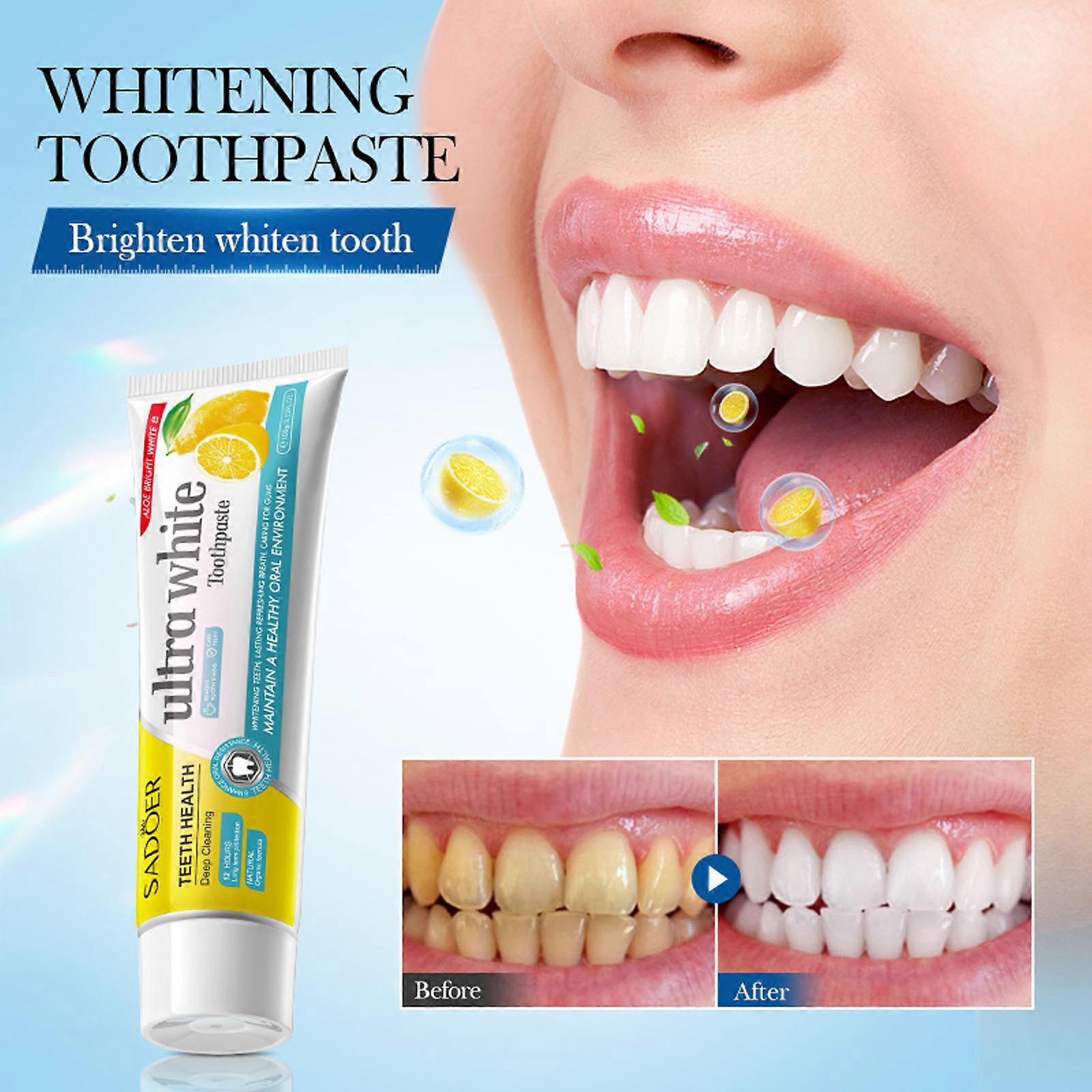 Lemon Whitening And Stain Removing Toothpaste Oral White Teeth And Gums ...