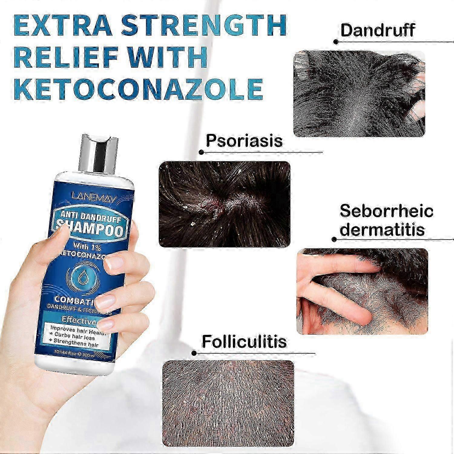 Anti-Dandruff Shampoo + Seborrheic Dermatitis Cream Set, Anti Fungal Shampoo, Scalp Treatment ...