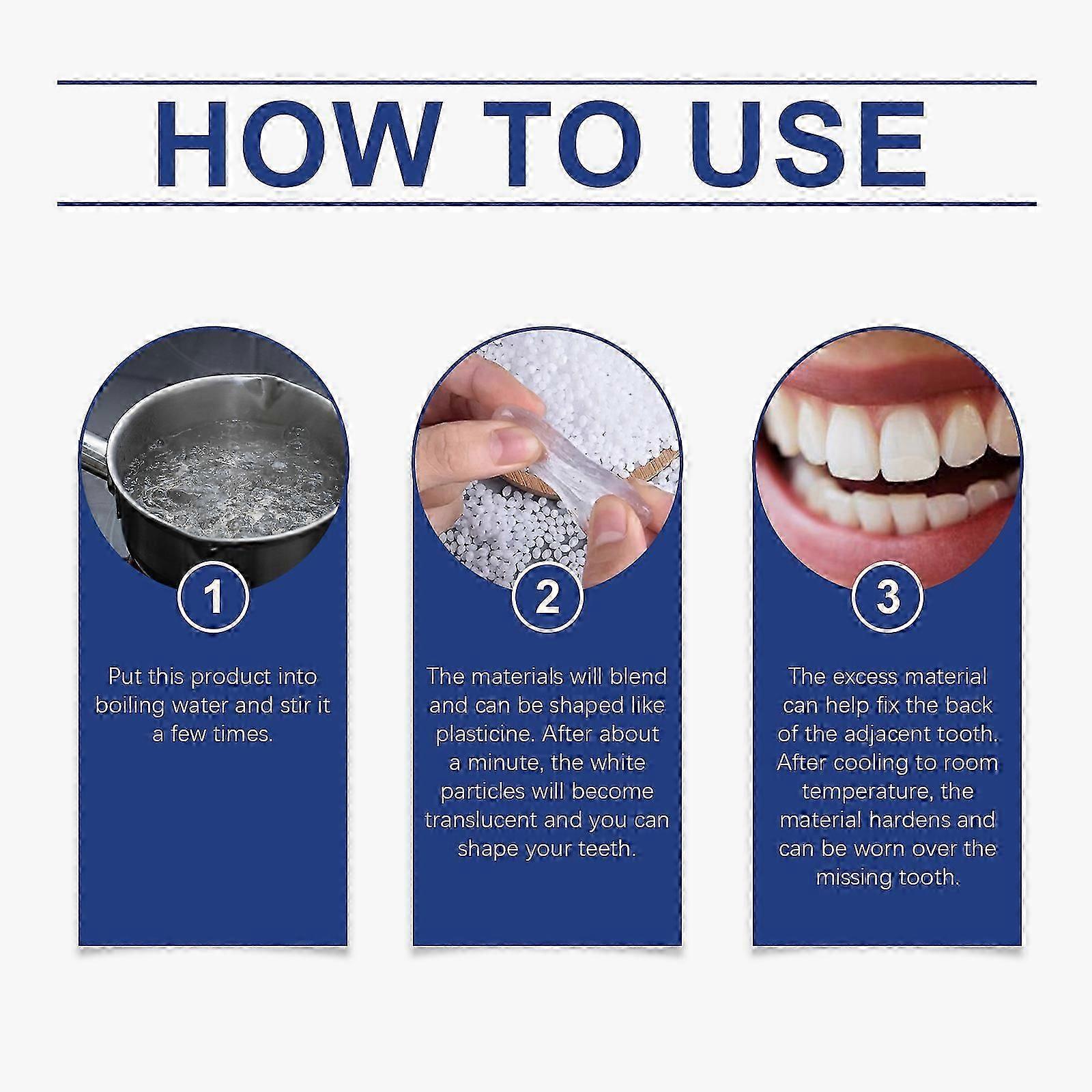 Tooth Repair Kit Temporary Tooth Filling Repair Beads Tooth Repair ...