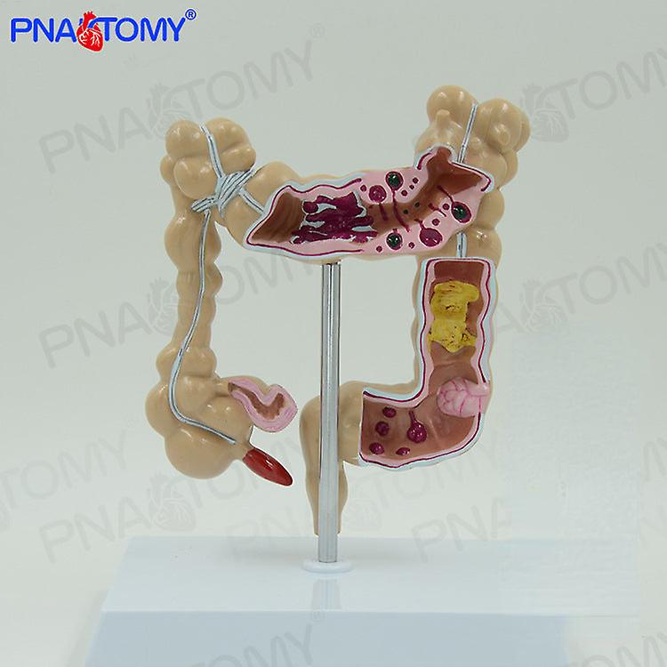 Human Model Simulation Human Colon Anatomy Model Anorectal Intestinal ...