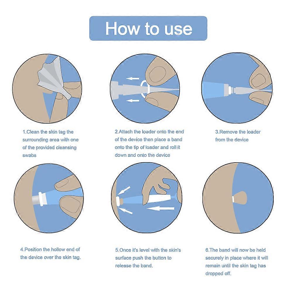 Remove Skin Tag Pen Facial Care Nevus Tool 2mm-4mm Remove Meat Nevus ...