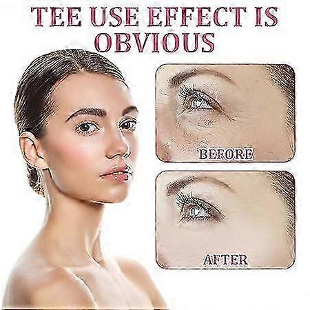 Micro Infusion System, Lip Fix Micro Infusion, Micro Infusion System ...