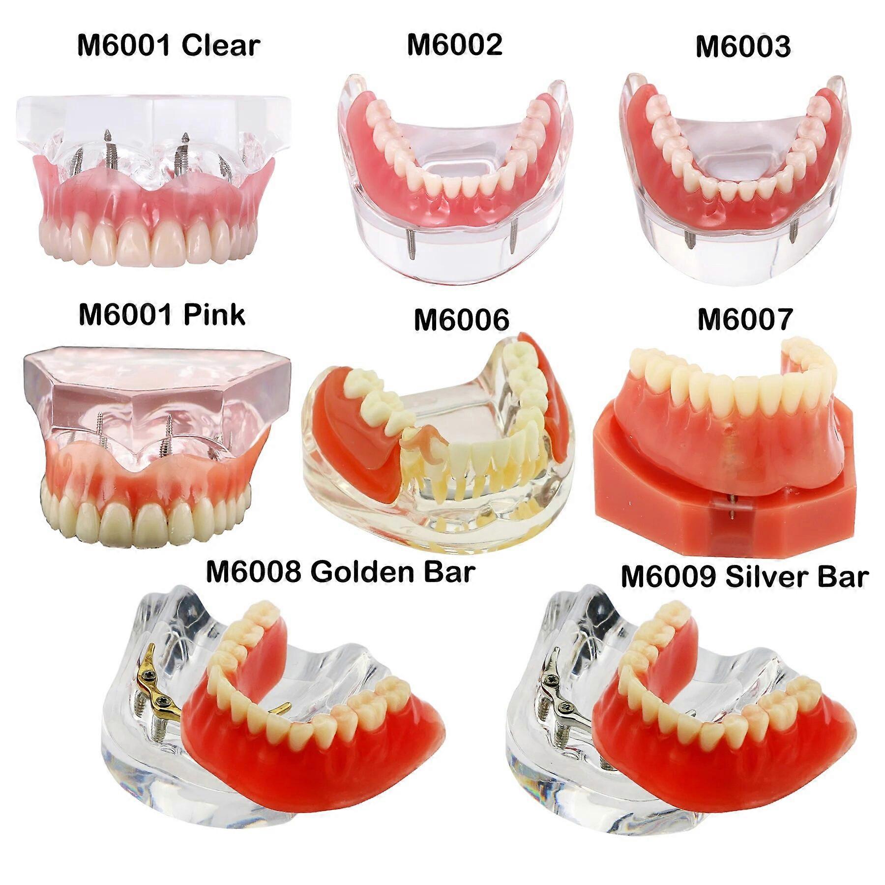 Dental Teeth Model Dental Teaching Models Implant Model Removable ...