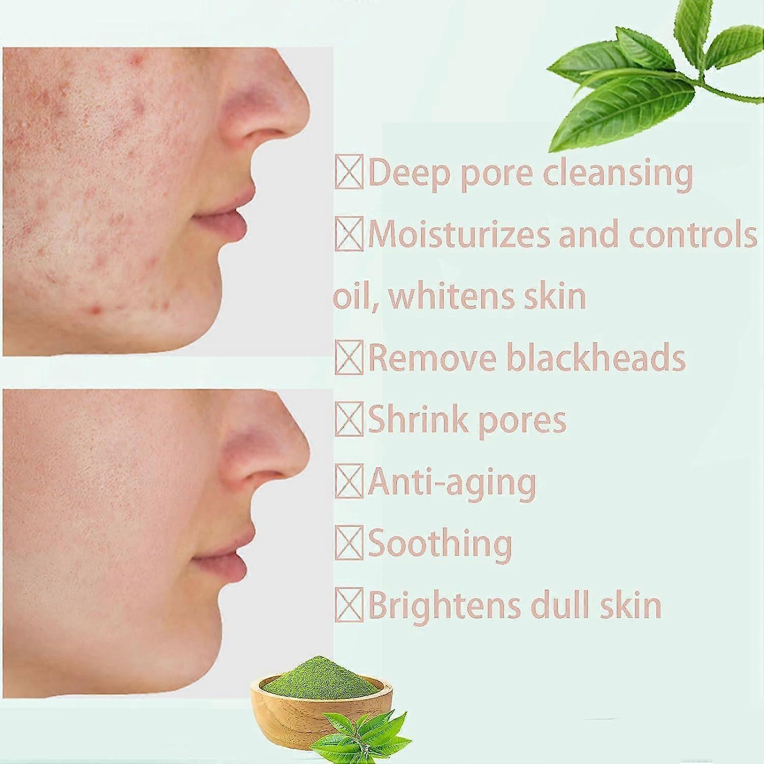 Mugwort Stick Mask, Mugwort Clay Mask, Skintific Mugwort Anti Pores ...