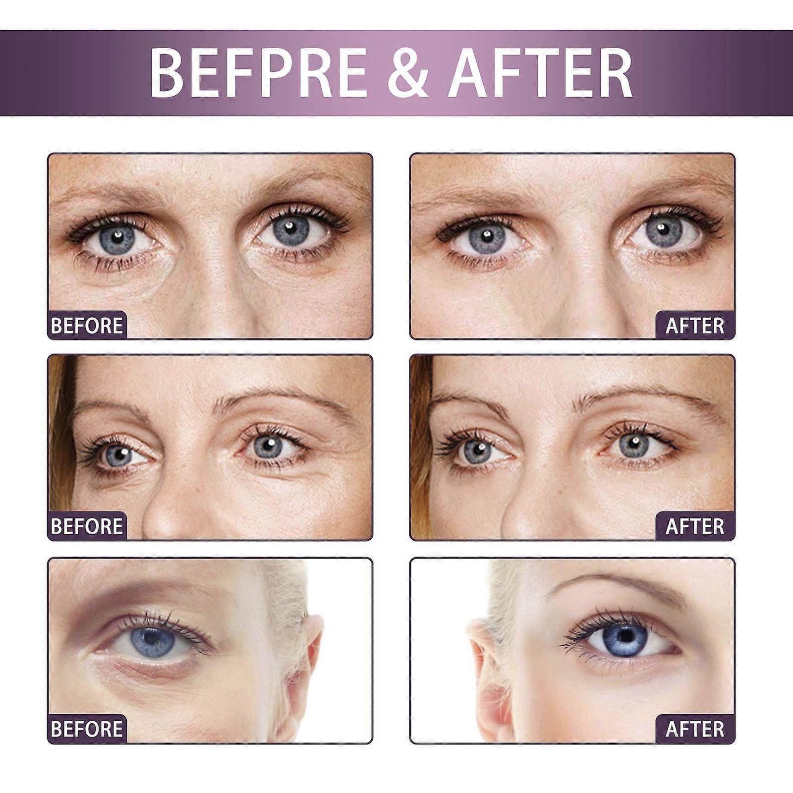 Eelhoe Anti-Wrinkle Eye Cream Lifting, Firming, Moisturizing And ...