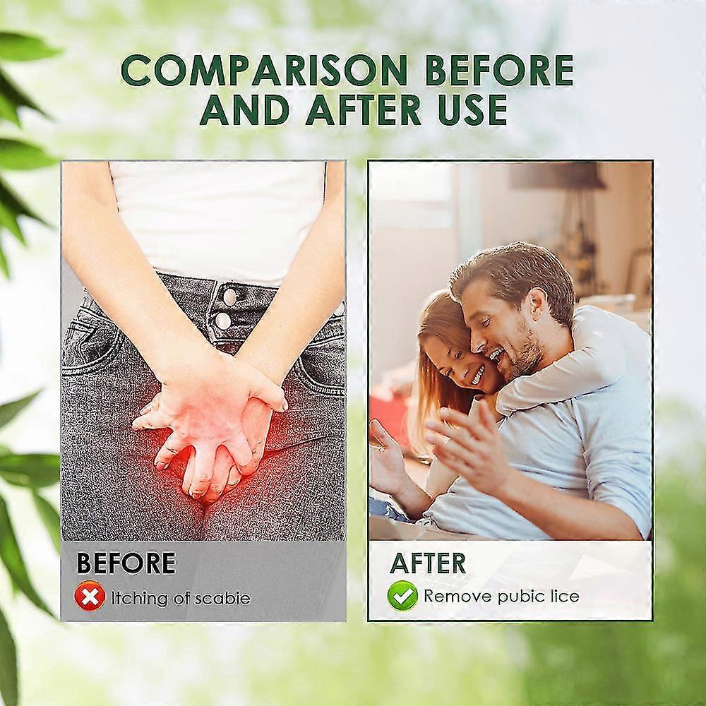 1/2pcs Pubic Lice Scabies Removal Cream Herbal Anti Lice Eggs Anti-itch ...