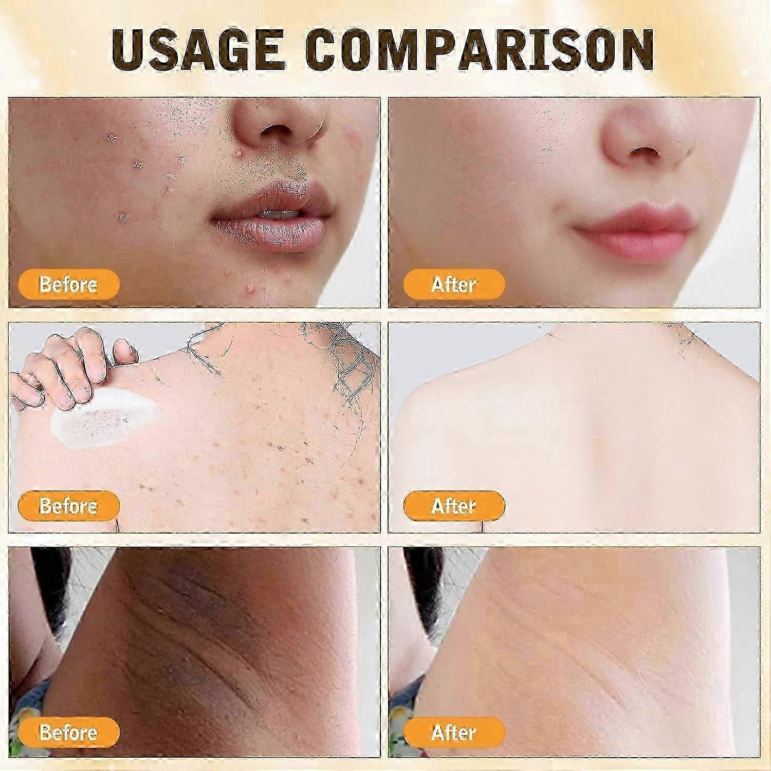 3pcs Bee Venom Repair Cream, Bee Venom Comprehensive Cream, Bee Venom ...