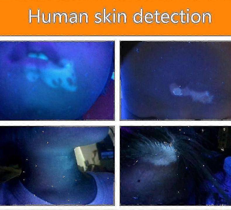 Lightweight Hand-held Wood Lamp Wavelength Ultraviolet Diagnostic Uv ...