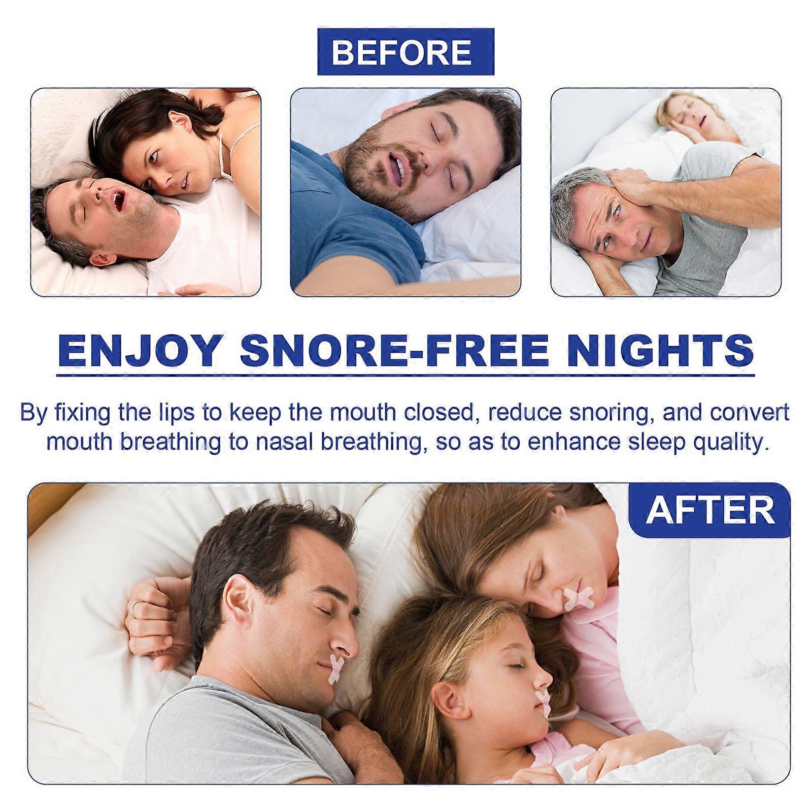 Anti-Snoring Tape Sleep Seal Anti-Snoring Open Mouth Breathing Closed Mouth Breathing Tape To ...