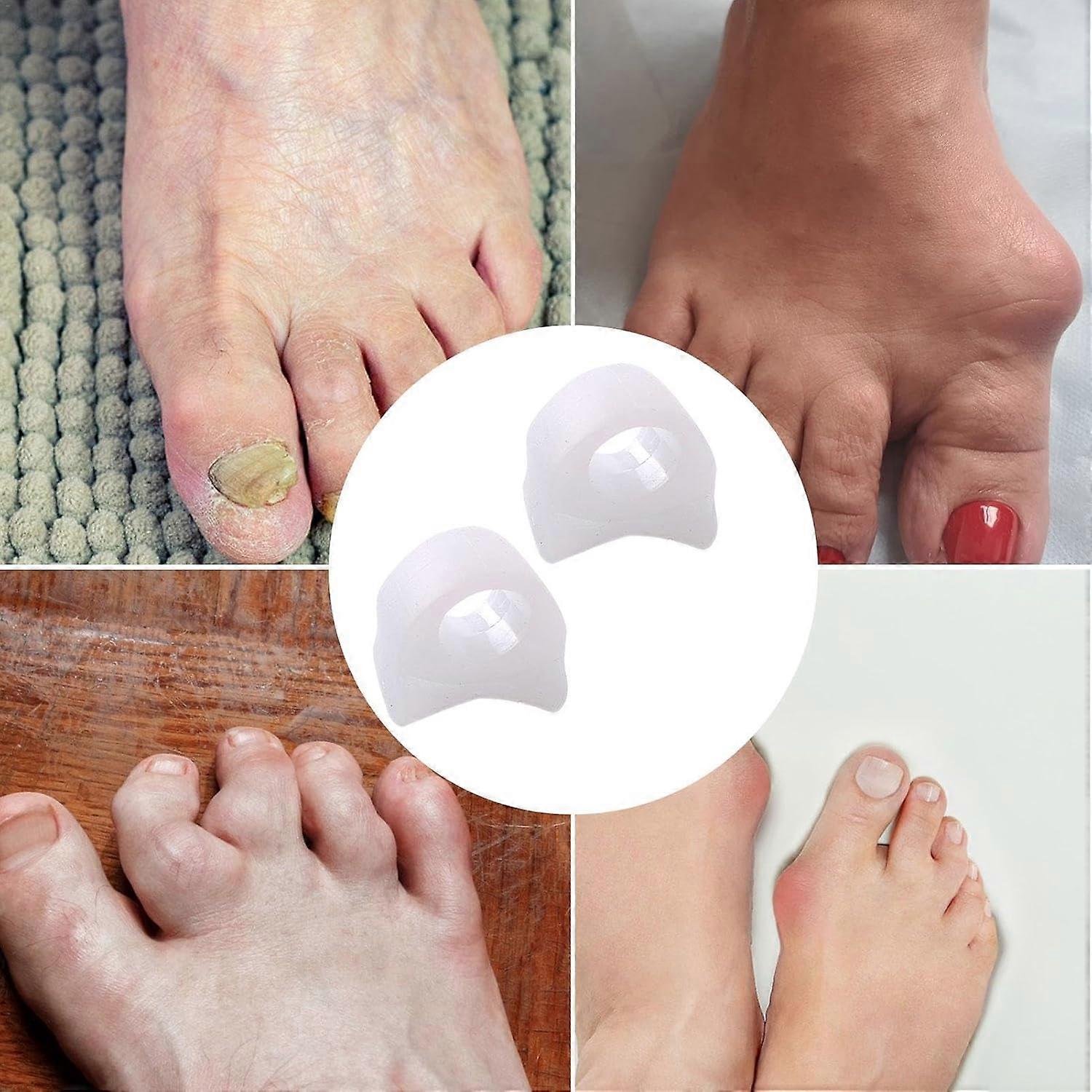 Toe Separators Gel Toe Separators Big Toe Alignment Comfortable ...