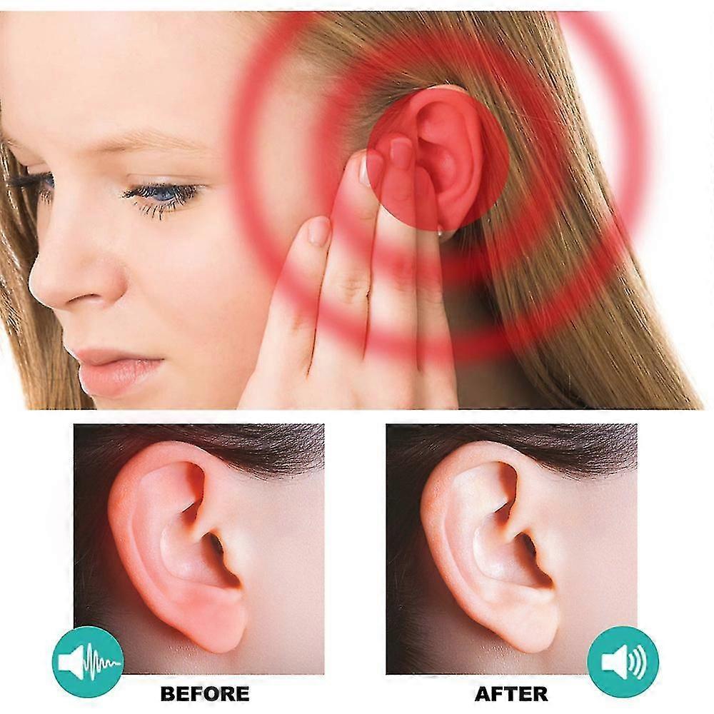 Tinnitus Ear Drops Ear Relieving Ear Wax Relieve Otitis Deafness ...