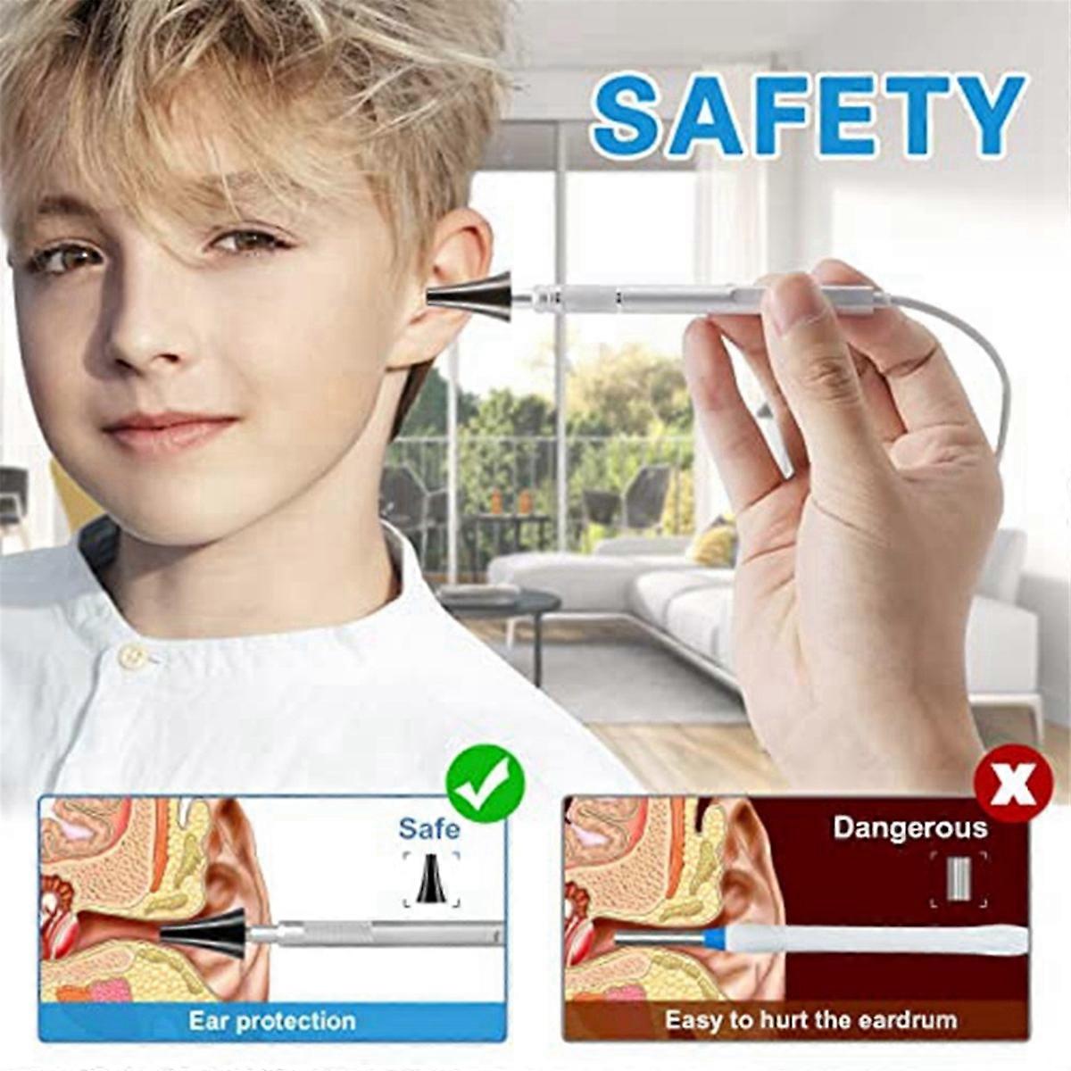 Digital Otoscope with 7-Inch Screen, Ear Camera, Visual Ear Scoop ...