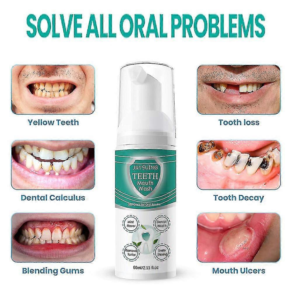 1-3pcs Mint Teeth Mouthwash, Herbal Brightening Oral Repair Foam, Solve ...