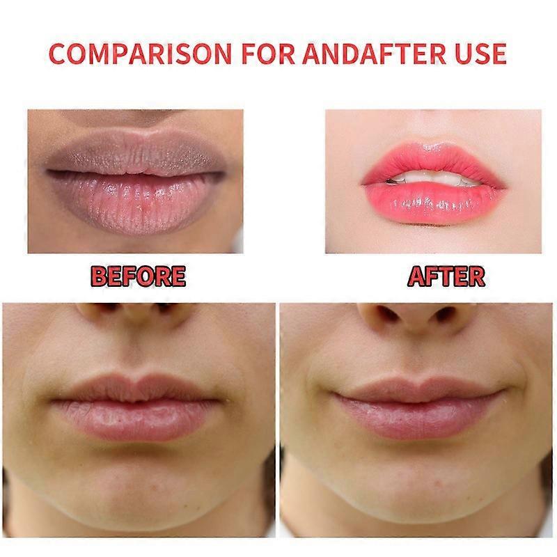 Dragons Blood Lip Rejuvenation Bubble Mask, Dragons Blood Lip Masks, Dragons Blood Rejuvenation ...