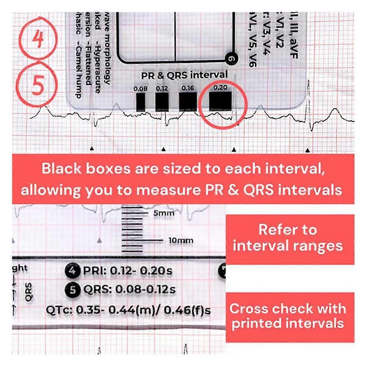 2PCS ECG 7 Step Ruler, ECG 7 Step Ruler for ECG/EKG Interpretation, ECG ...