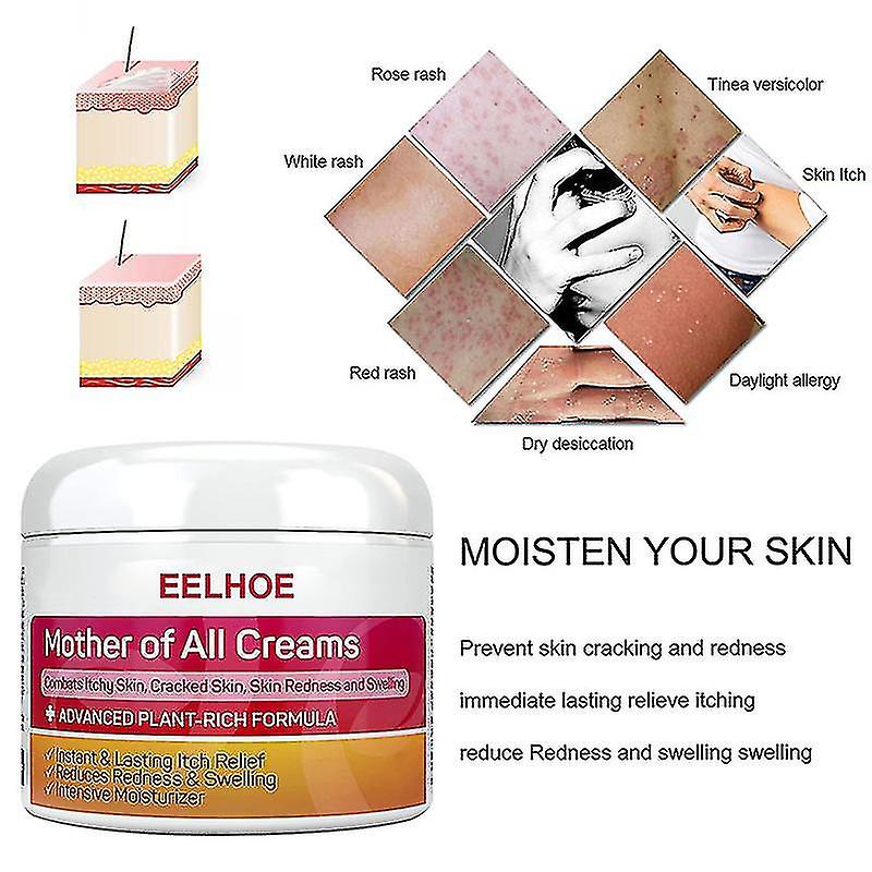 Eczema Cream Psoriasis Cream Antibacterial Cream Skin Dermatitis ...
