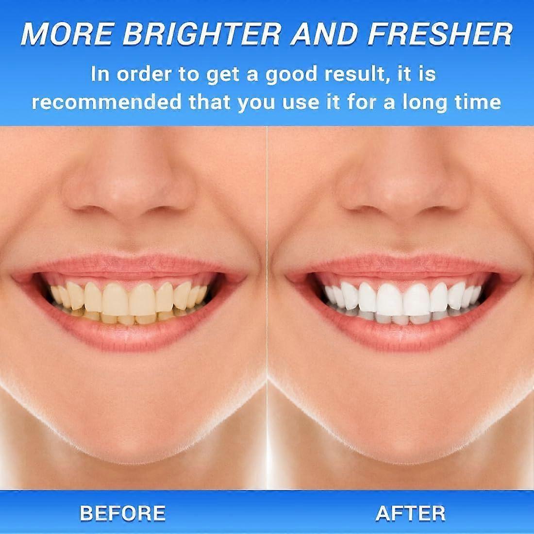Body Toothpaste,Niacinamide Whitening Toothpaste for Sensitive Teeth ...