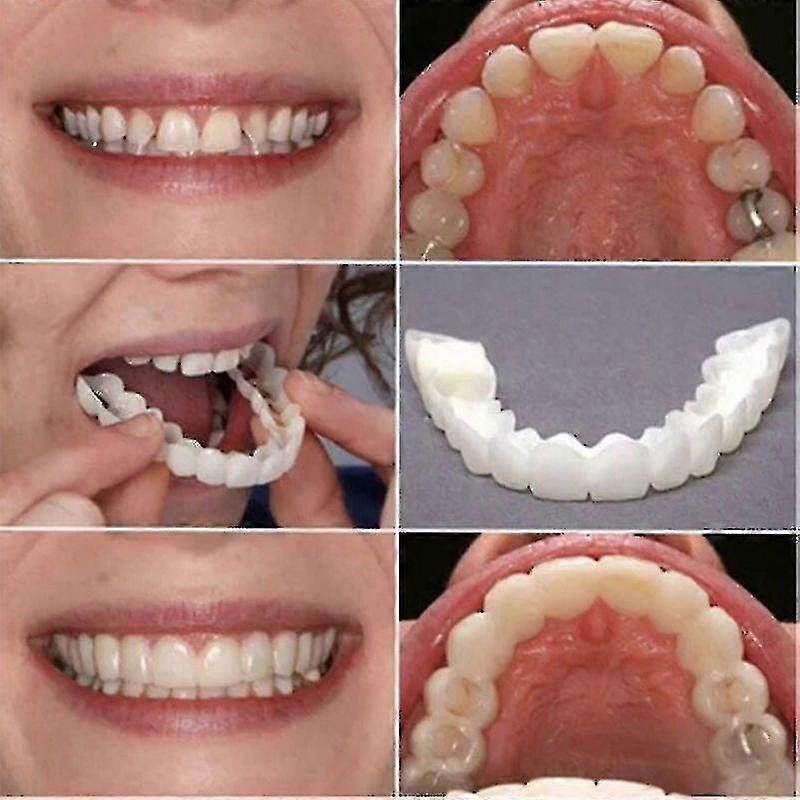 Reusable Denture Braces No Drilling Temporary Fake Teeth Veneers Snap ...