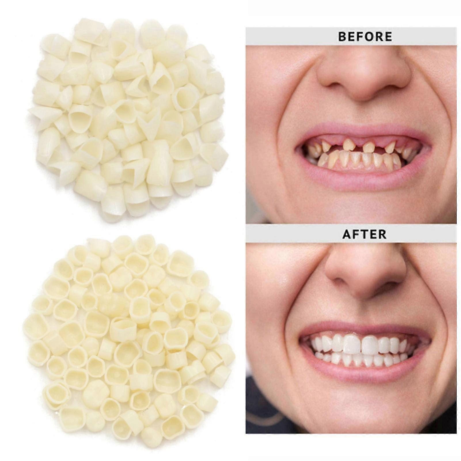 Temporary Dental Teeth Cover Anterior Molar /back Tooth Caps For Women ...