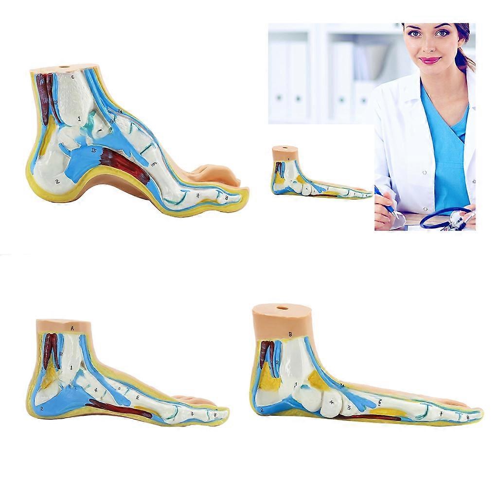 Normal/Flat/High Arched Foot Anatomy Model, Anatomical Human Foot Ankle ...