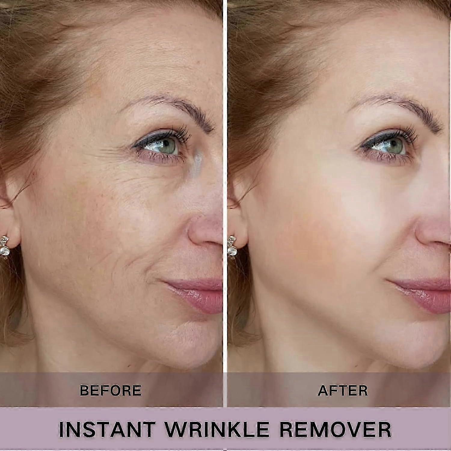 Instant Wrinkle Remover for Face, Instant Face Lift Cream, Instant Face ...