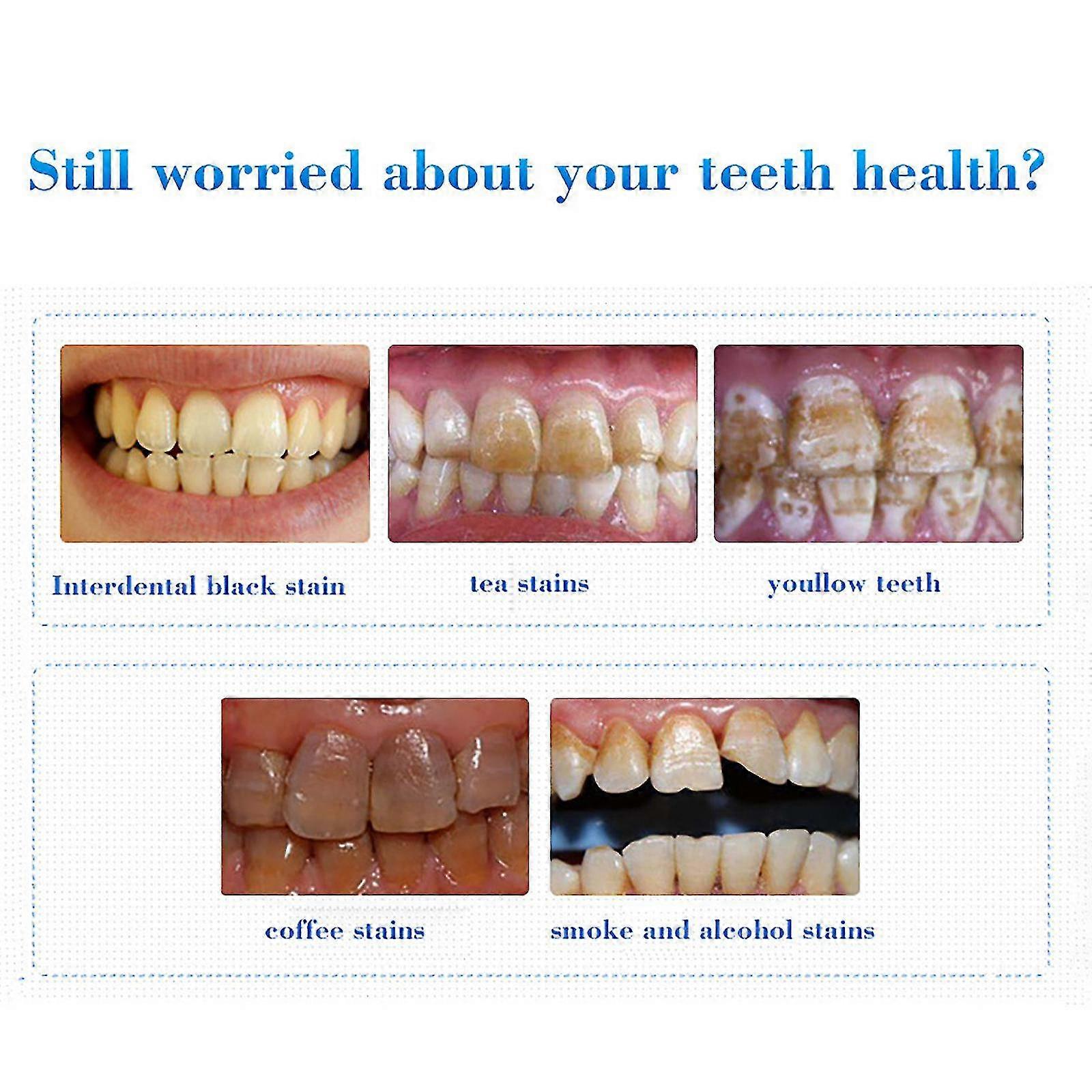 Efero Teeth Yellow Tooth Tooth Stain Plaque Tooth Scaling Liquid ...