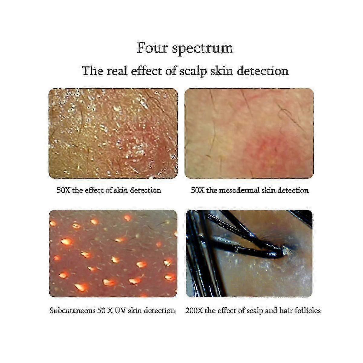 11 Inch LCD Skin Hair Scalp Analyzer Detector Digital Microscope ...