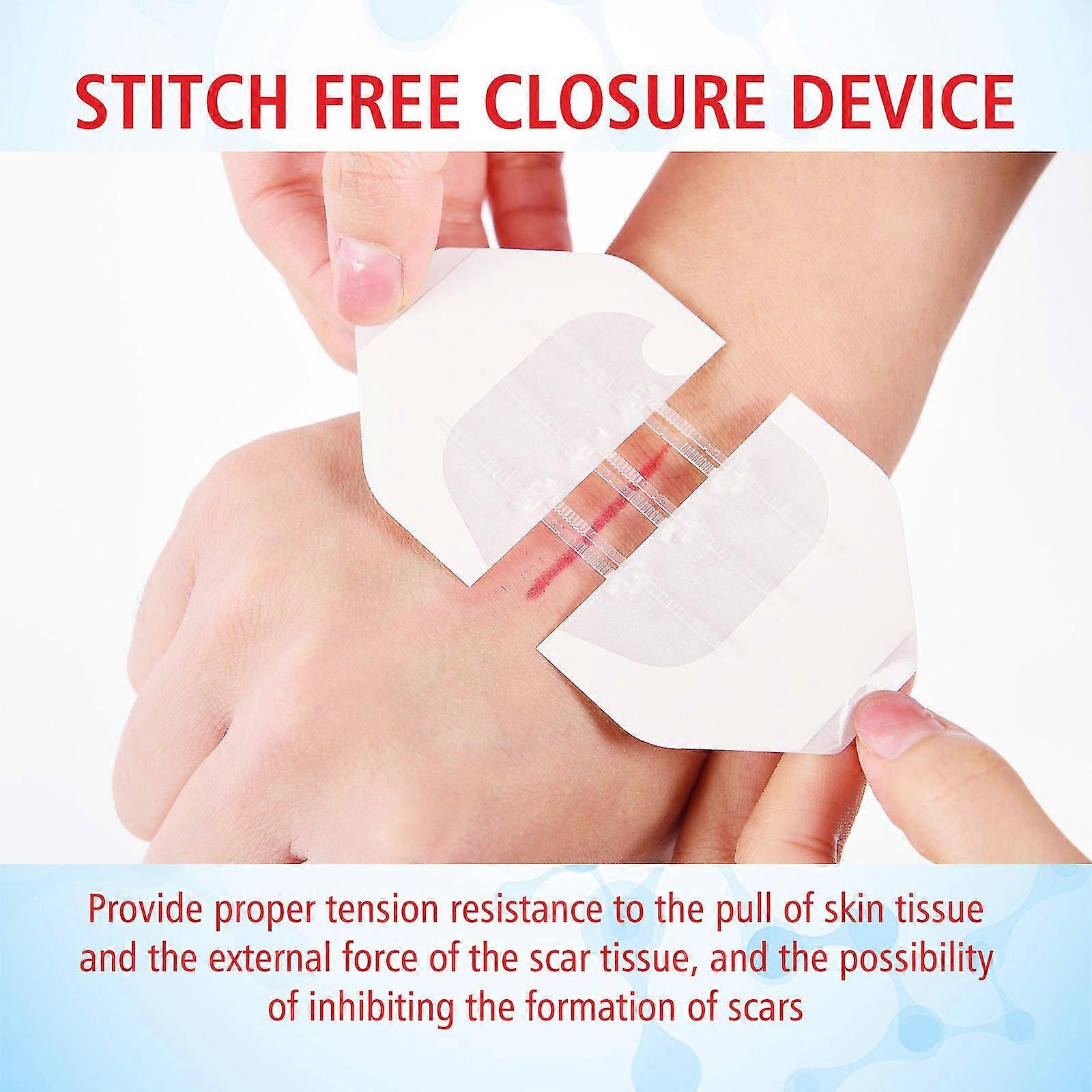 Sutures Butterfly Bandaids, Emergency Wound Closures Device, Surgical ...