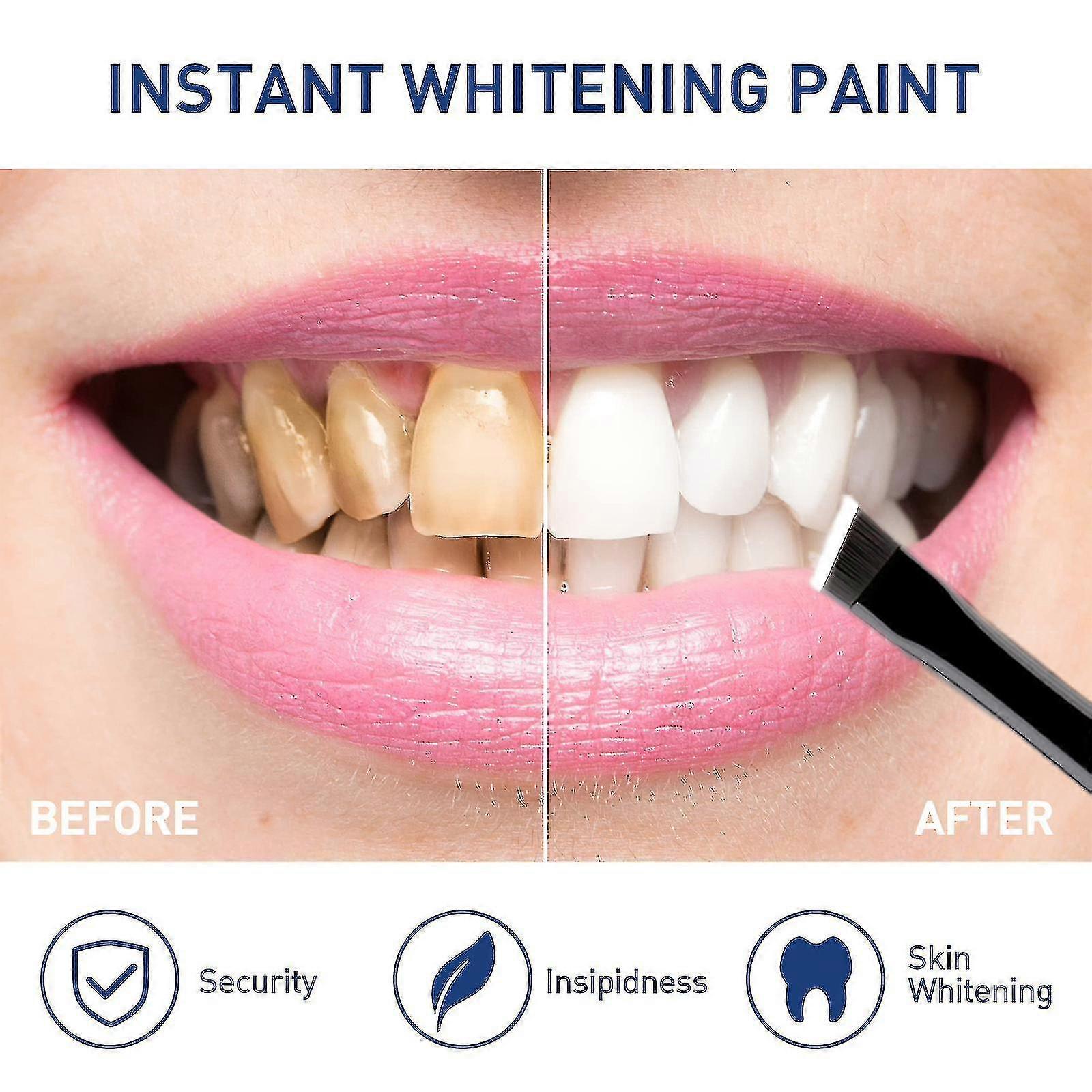 Jaysuing Of Teeth Whitening Paint To Remove Tooth Stains, Tooth Dirt ...
