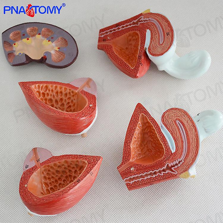 Human Male And Female Urinary System Bladder Abdominal Cavity Abdominal ...