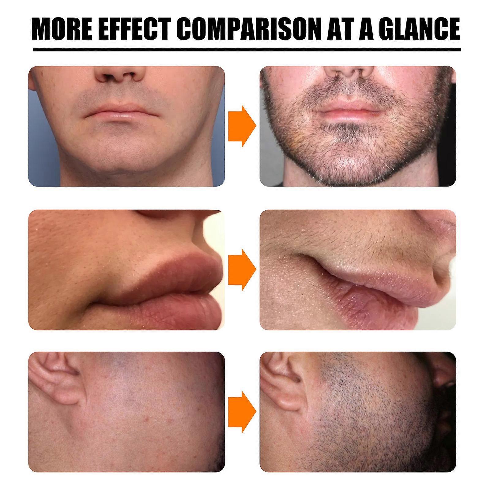 Natural Men Beard Growth Roller Kit Men's Beard Growth Oil Nourishing ...