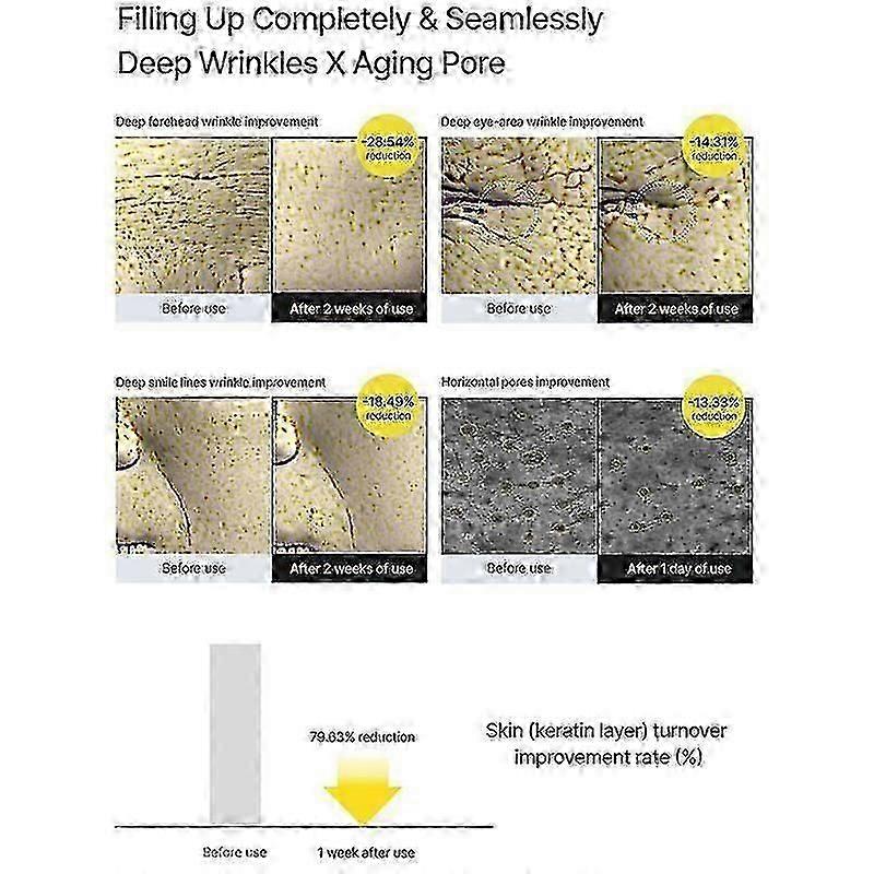 The Vita A Retinol Shot Tightening Booster Anti-Aging- 15ml | Fruugo UK