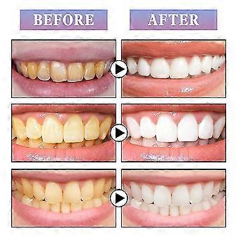 1-3pcs Tooth Gloss, Instant Gloss Results | His Smile Tooth Gloss ...