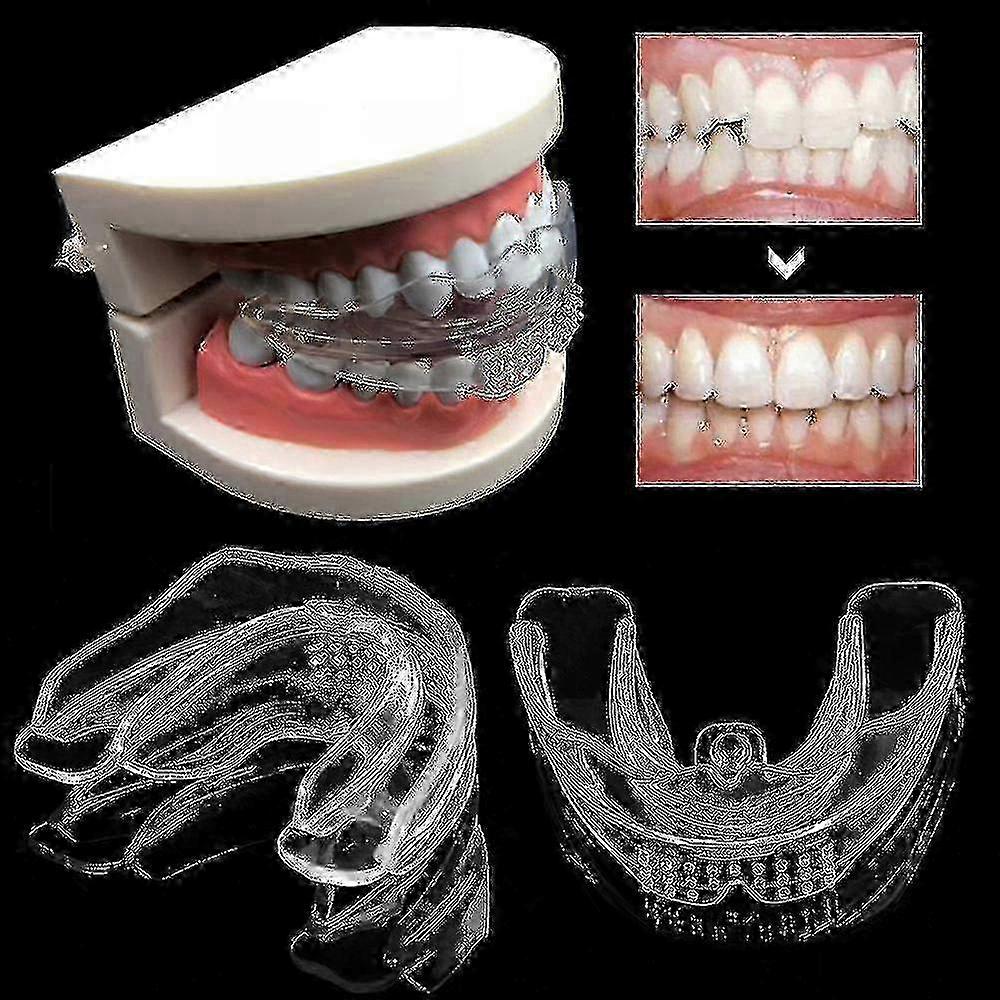 New Teeth Orthodontic Braces Appliance Dental Braces Silicone Alignment ...