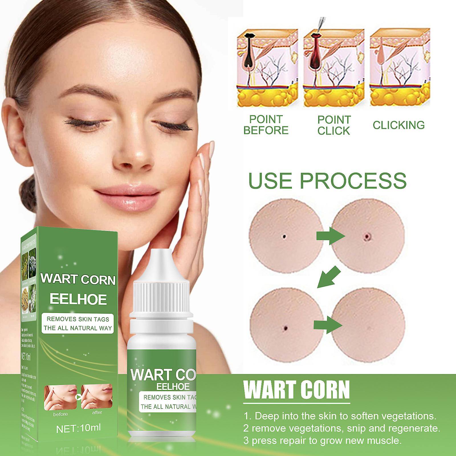 Mole Elimination Potion Skin Removal Of Black Spots Fades Melanin ...