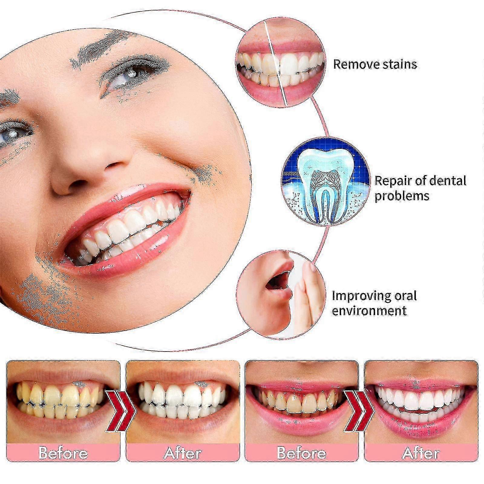 Jaysuing Toothpaste Whitening Teeth Stain Removal Fight Bleeding Gums ...