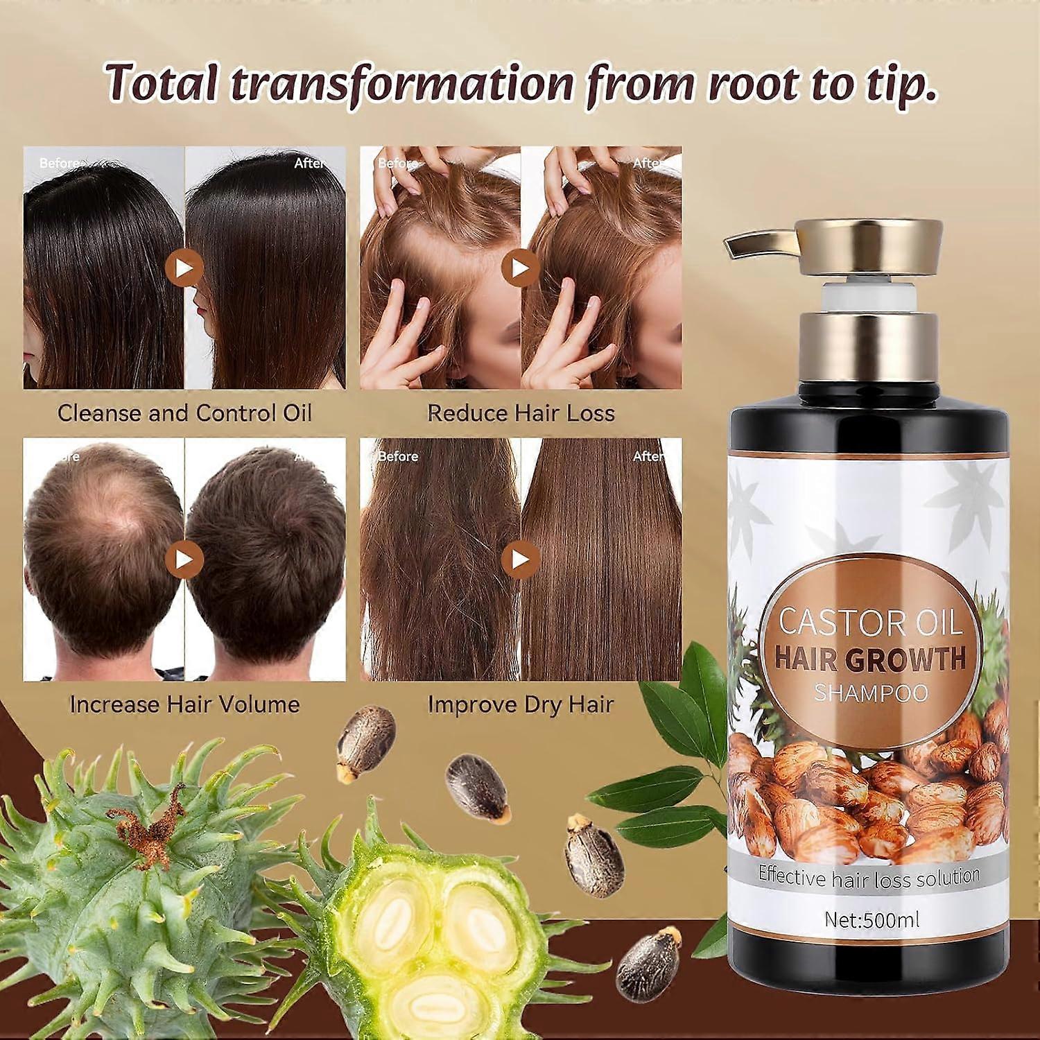Castor Oil Shampoo for Hair Growth, 500ml Hair Repair Shampoo Against ...