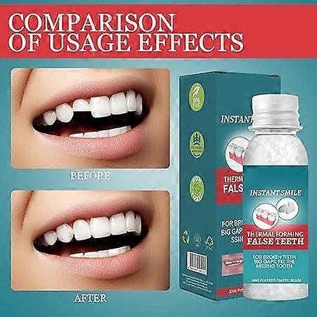 Dental Repair Kit Permanent Dentures Repair Kit Temporary Dentures ...