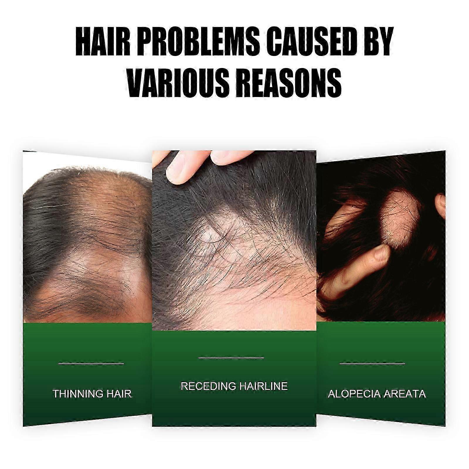 West&Month rosemary thick hair essential oil Repair dry and frizzy hair ...