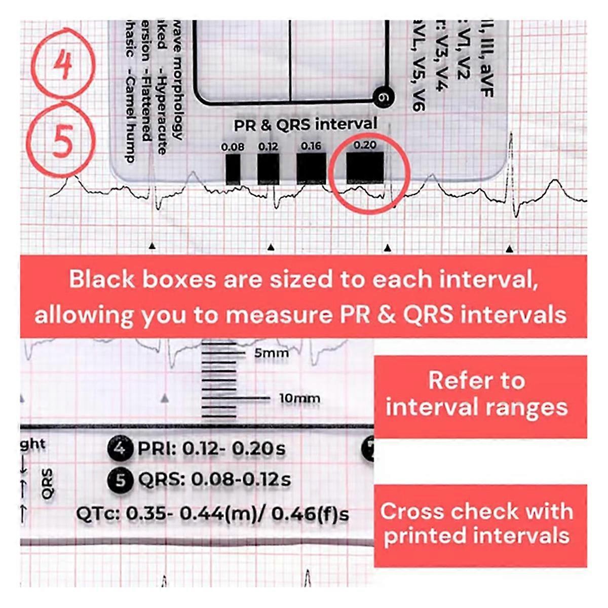 2PCS ECG 7 Step Ruler, ECG 7 Step Ruler for ECG/EKG Interpretation, ECG ...
