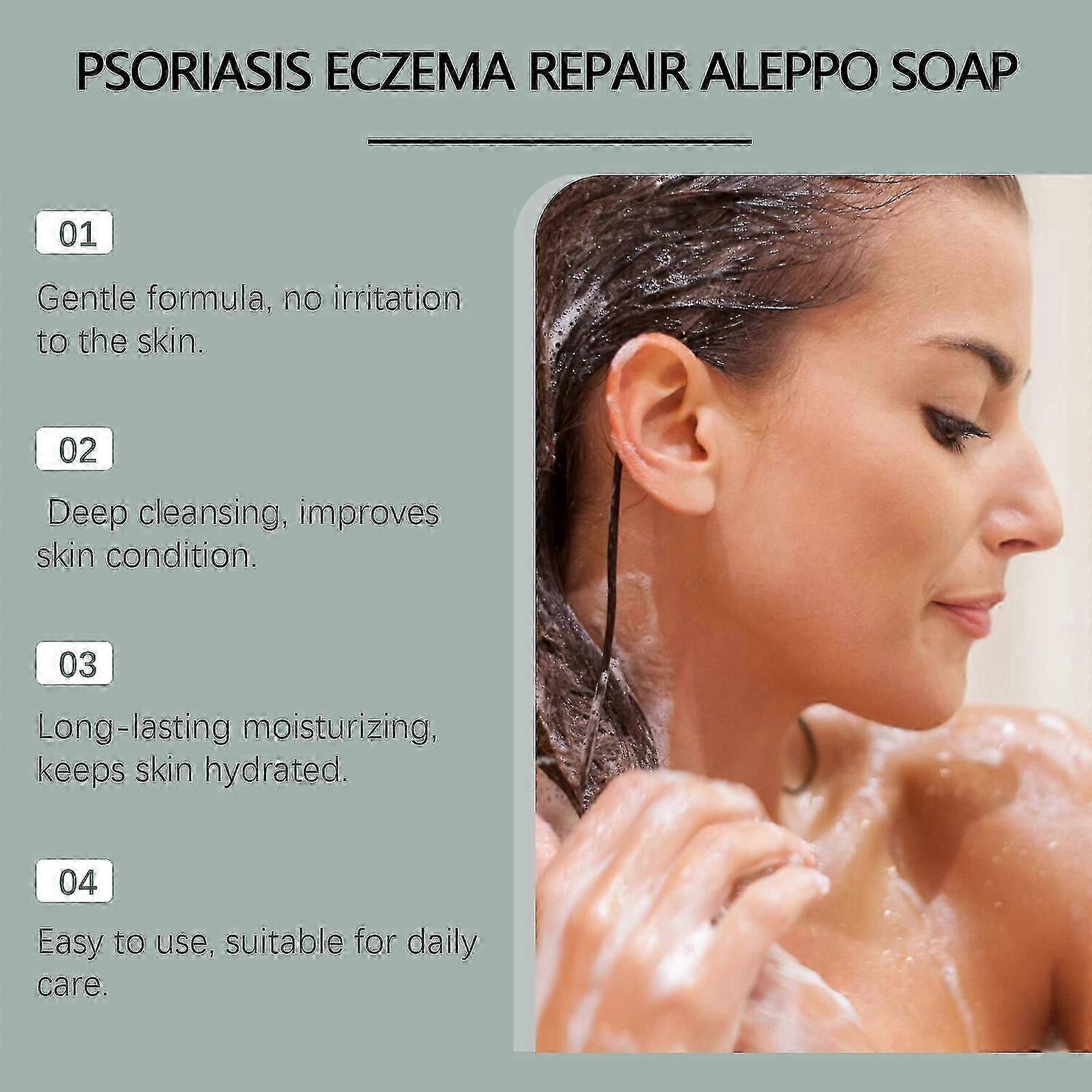 Psoriasis Soap, Psoriasis & Eczema Soap Bar for Face and Body, All ...