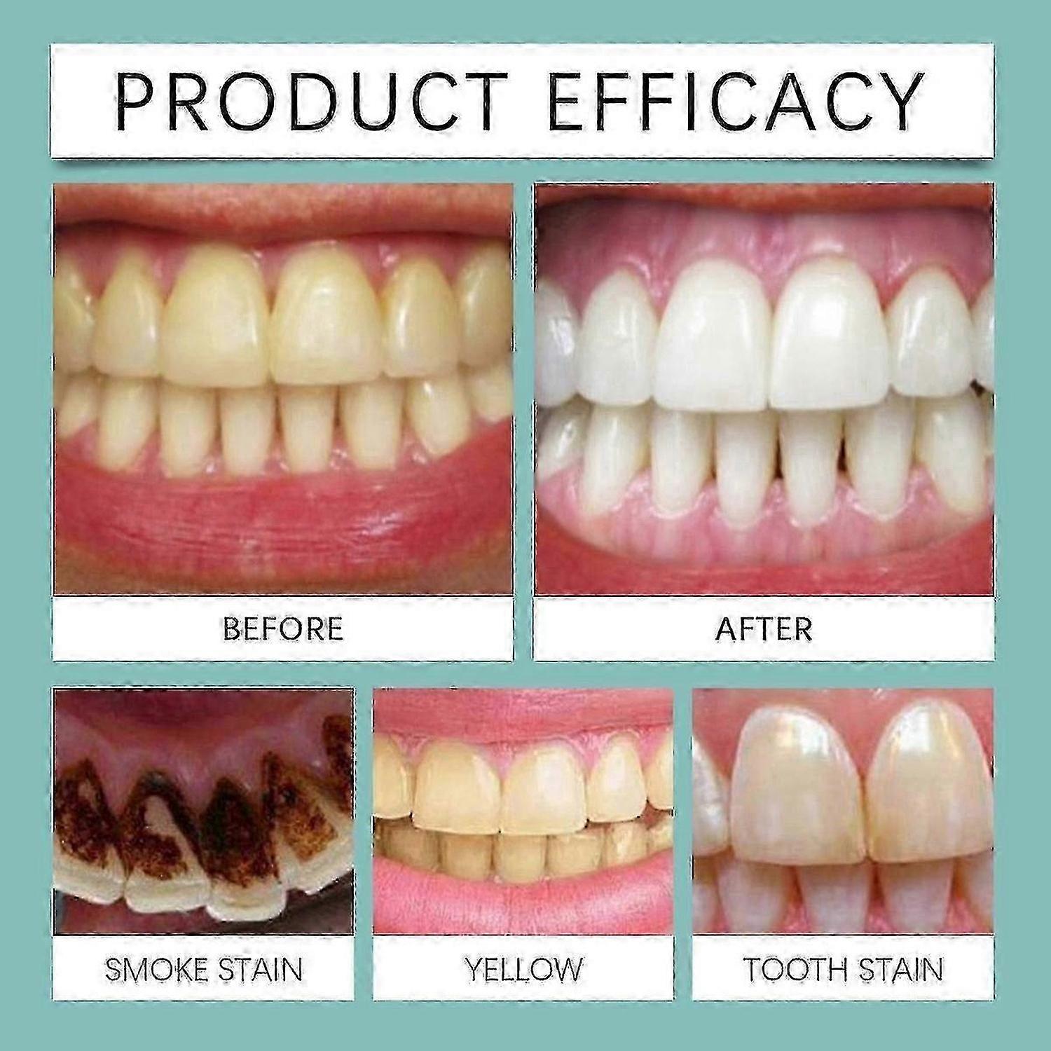 Oralhoe Instant Tooth Whitening Tooth Paint, Clean The Tartar Very Well ...