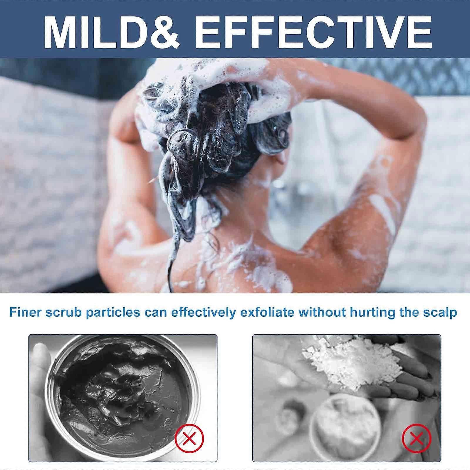 Sulfur Shampoo For Removing Lice, Relieving Itching, Controlling Oil ...