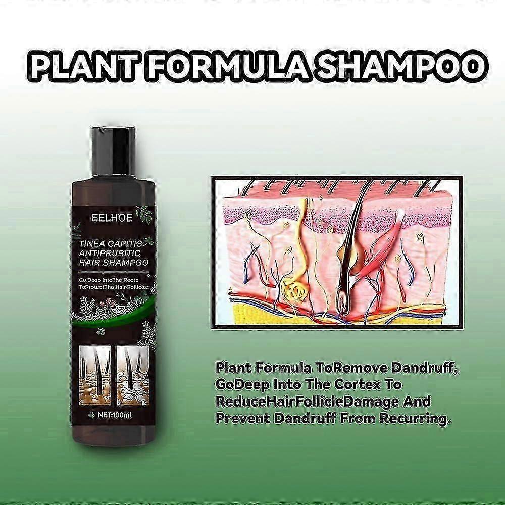 100ML Anti-Dandruff Anti-Itch Shampoo for Itchy Scalp Care, Cleansing ...