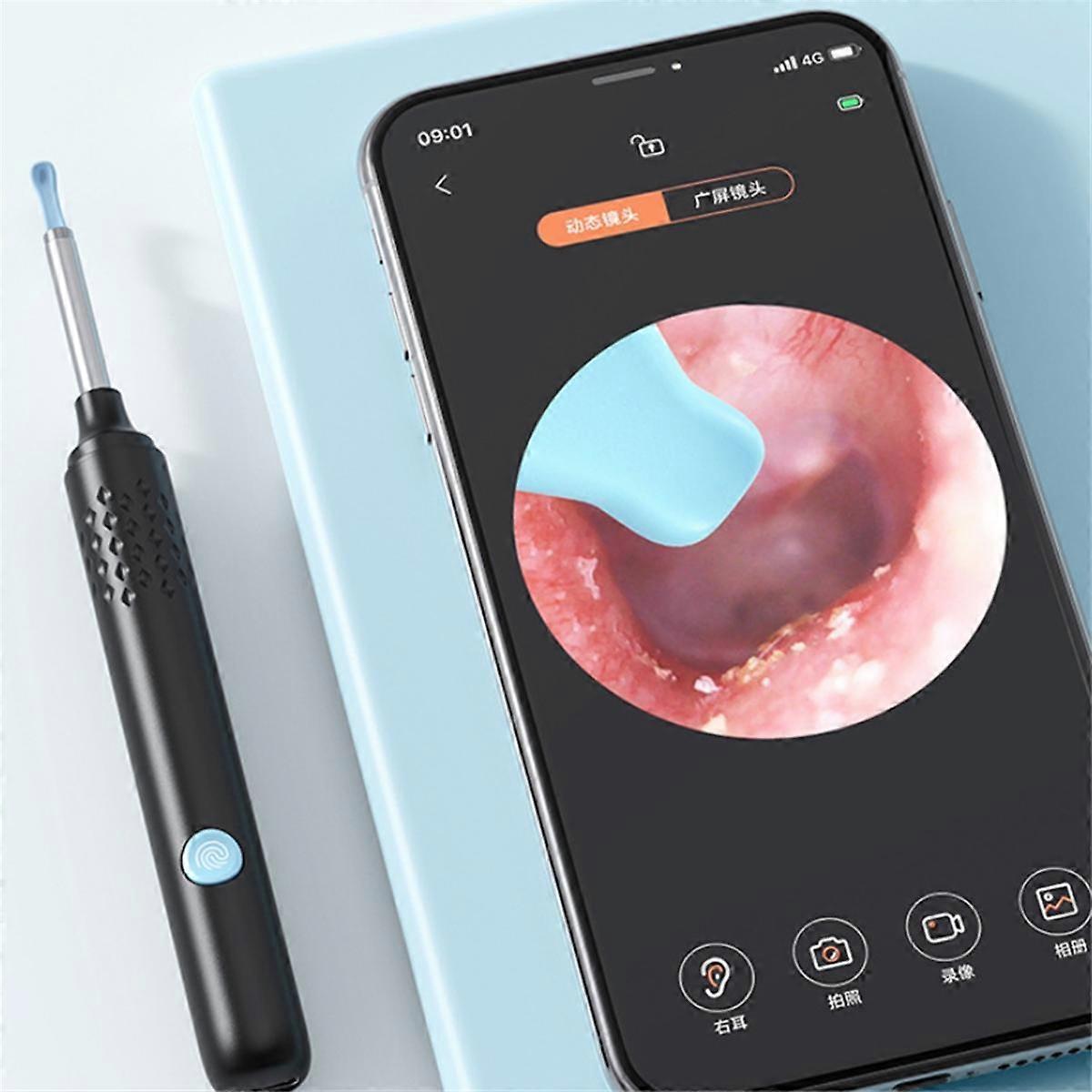 Ear Wax Remover, Ear Cleaning Kit with 6 Ear Picks, Ear Cleaning ...