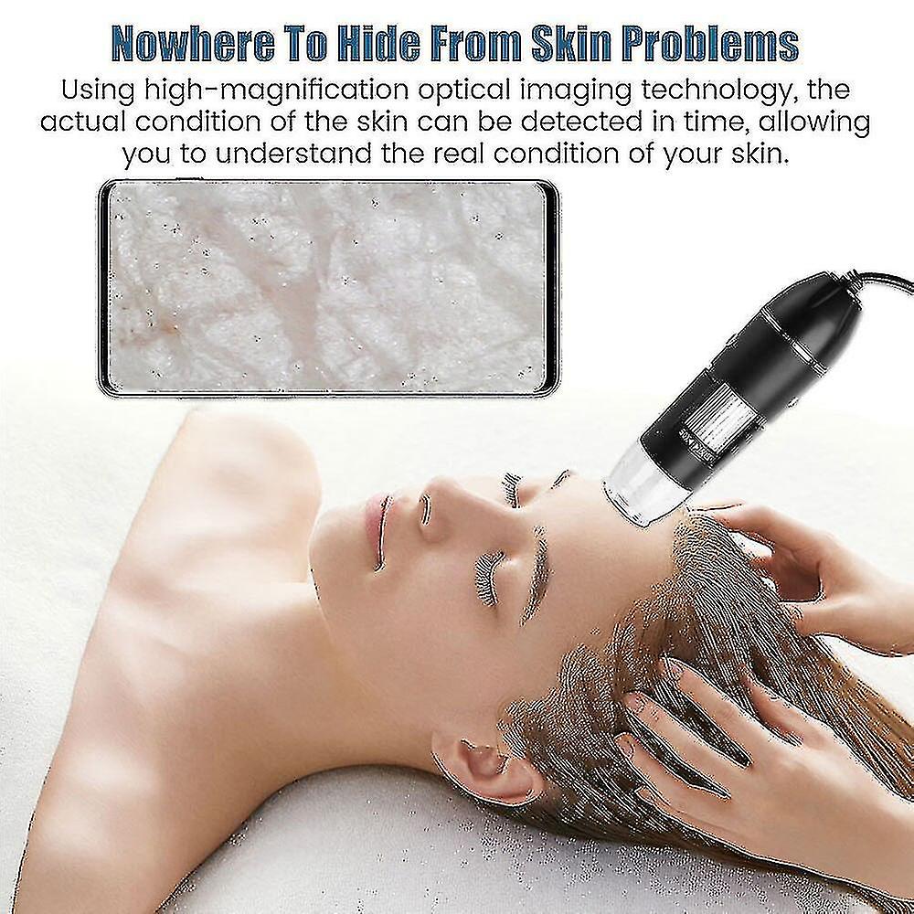 1600x Dermatoscope Skin Analyzer Machine Usb Scalp Diagnostic Machine ...