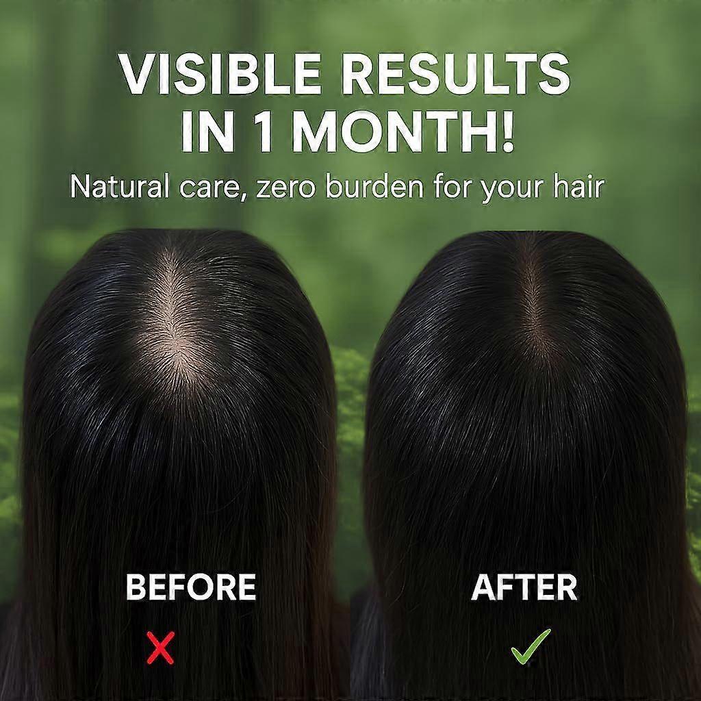 Nature Triangle Shampoo Bar, Nature Seven Green Soap Shampoo, Natural ...