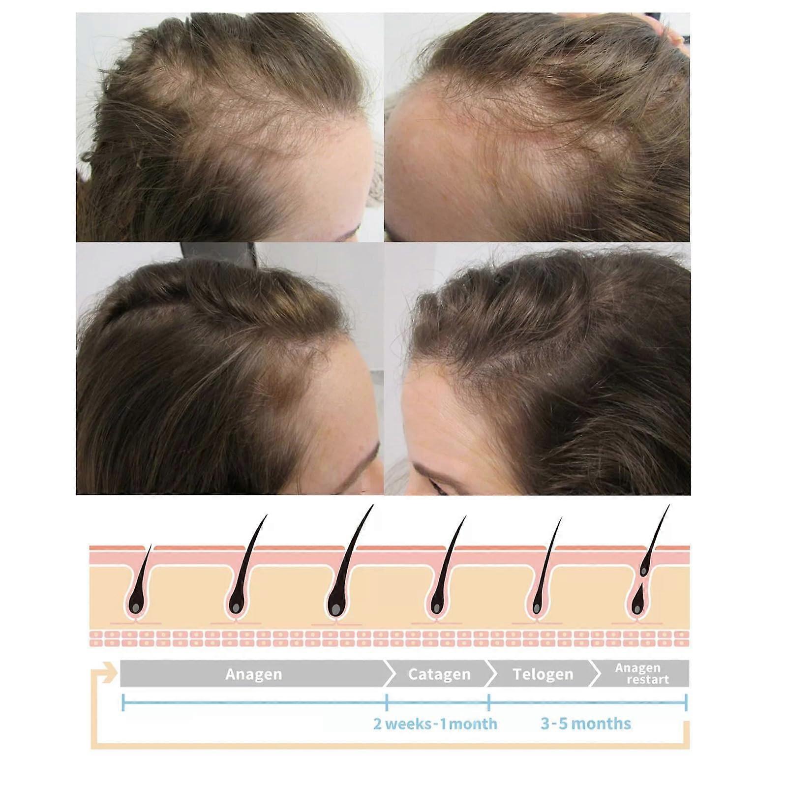 Comb Bundle, Hair Comb Hair Rejuvenator Brush EU Plug, High Frequency ...