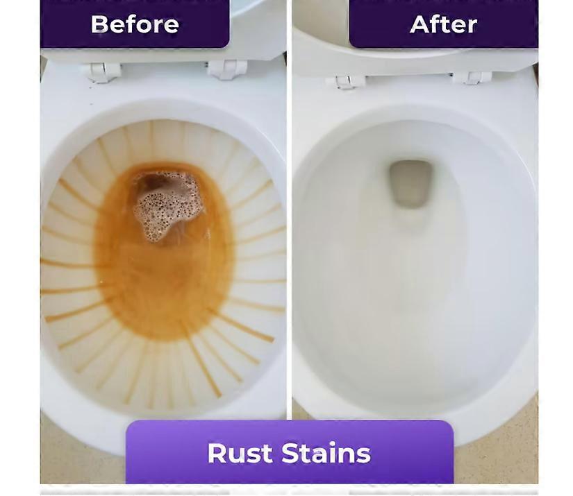 Toilet Cleaner, Insta-Action Fizzclean Foam For Sparkling Clean Toilet ...